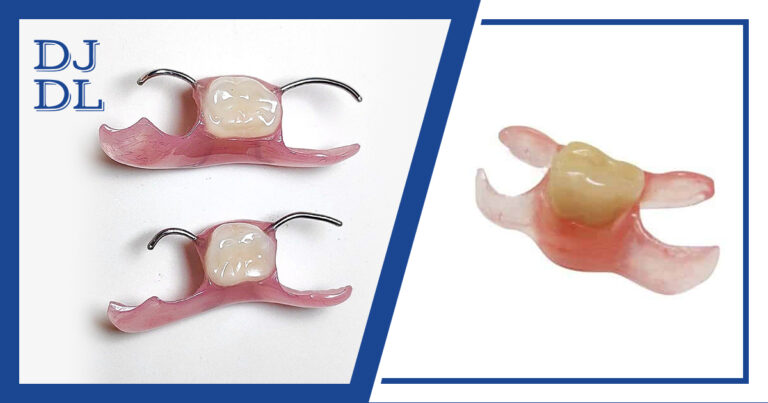 Nesbit partials: Everything you need to know. | Blog, Nesbit